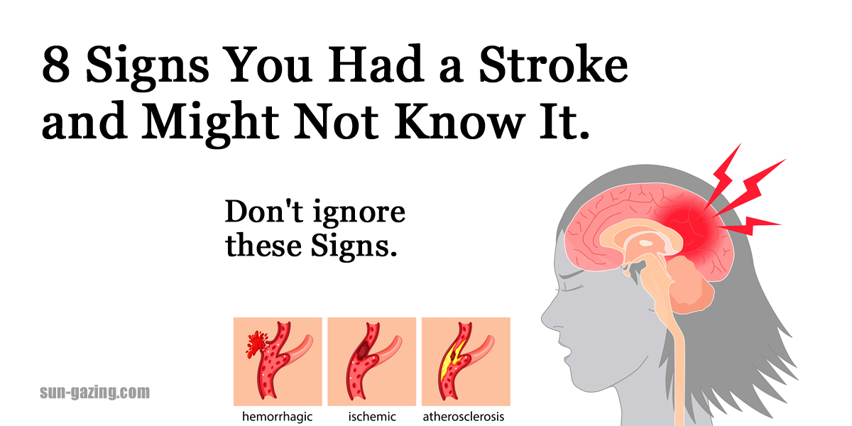 8 Signs You Had A Stroke And Might Not Know It Don t Ignore These Signs 