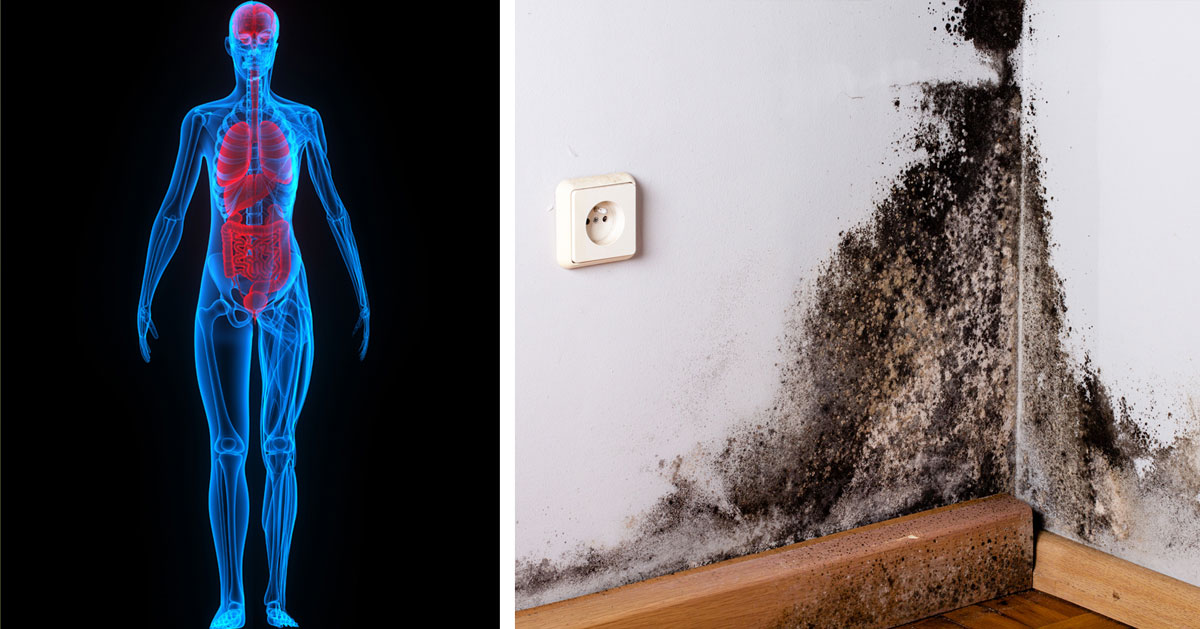 6 Signs You Have Mold Illness And May Not Even Know It