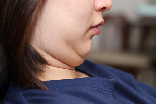 The Easiest Way To Deal With That Double Chin