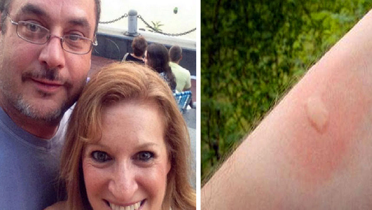 THIS Woman's Husband For Over 26 Years Died From THIS Common Bug Bite!