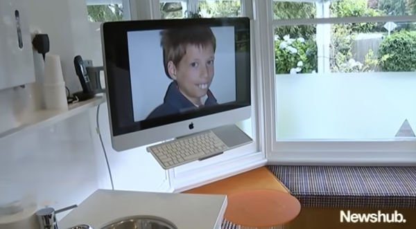 This Boy Was Called 'Rabbit Boy' and Bullied His Whole Life.