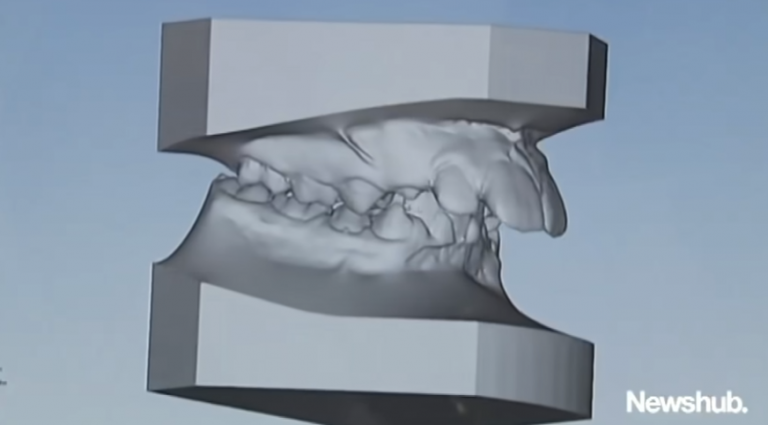 This Boy Was Called 'Rabbit Boy' and Bullied His Whole Life.